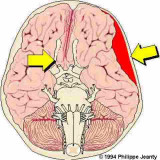 First aid for Cerebral Compression - First Aid for Free
