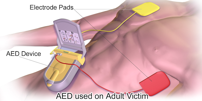 How does an AED work? - First Aid for Free