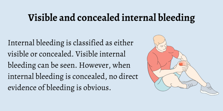 First Aid For Internal Bleeding - First Aid for Free
