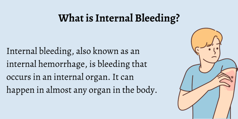 First Aid For Internal Bleeding - First Aid for Free