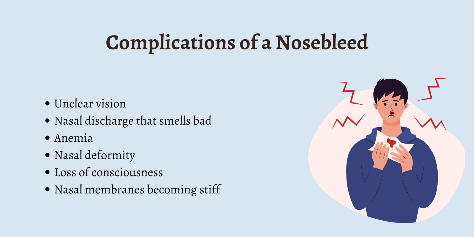 How to Stop Nosebleeds - First Aid for Free